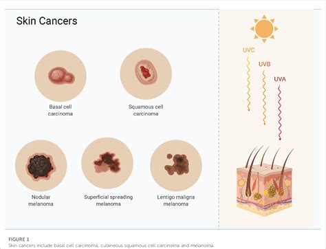 Table 1 From Non Coding Rnas In Skin Cancersbiological Roles And