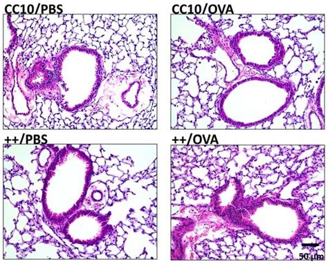 Mouse Lung Histology After Ova Challenge The Mouse Lungs Were Fixed