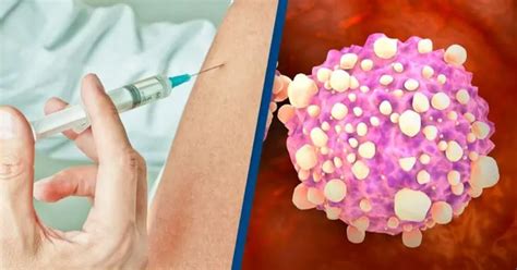 Cáncer De Páncreas Los Detalles De La Nueva Vacuna De Arnm Que Mostró