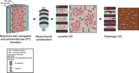 Schematic Of Intervertebral Disc Development And Degeneration Healthy