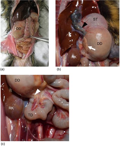 Macroscopic Appearance Of The Dilated Duodenum A Diseased Case Case