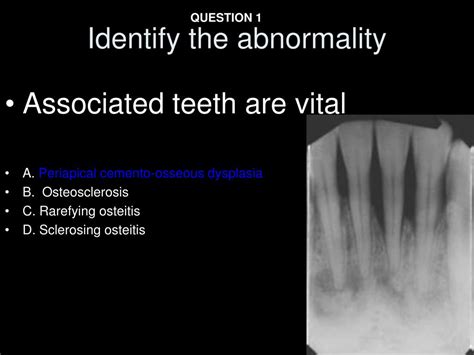 Ppt Identify The Abnormality Powerpoint Presentation Free Download