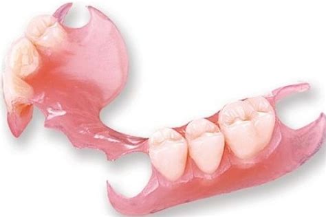 Valplast™ Partials Lakeview Dental