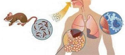 Autoridades Sanitarias Argentinas En Alerta Por Brote De Hantavirus