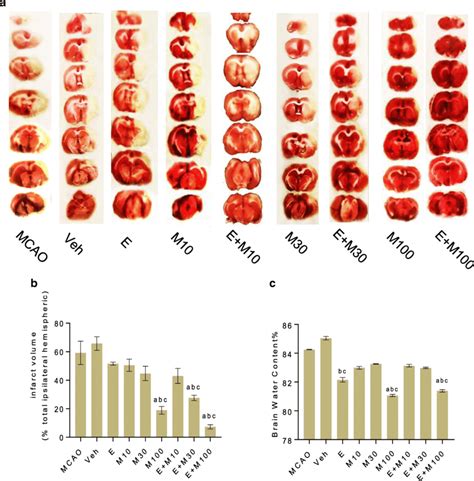 Comparison Of Cerebral Infarct Volume And Edema 24 H After Mcao A Download Scientific