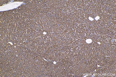 Ihceasy Lamp2 Ready To Use Ihc Kit Khc1363 Proteintech
