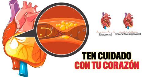 Enfermedades Cardiovasculares Son La Primera Causa De Muerte En México