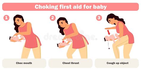 Heimlich Maneuver Stock Illustrations 96 Heimlich Maneuver Stock