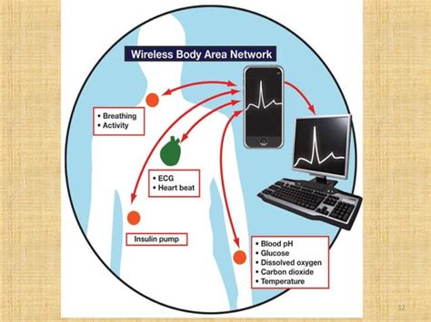 Wireless Body Area Network Ppt