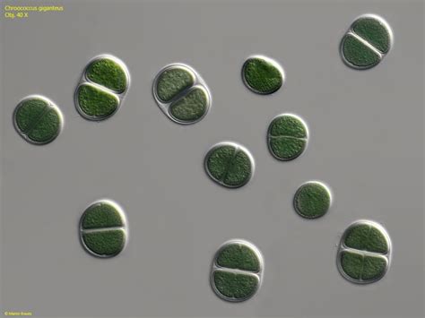 Chroococcus Giganteus Real Micro Life Chroococcus Giganteus Real Micro Life