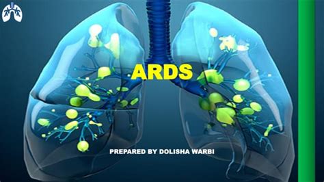Ards Acute Respiratory Distress Syndromepdf