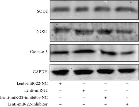 Cellular Apoptosis And Ros Generation In Mir 22 Modified Rbmscs