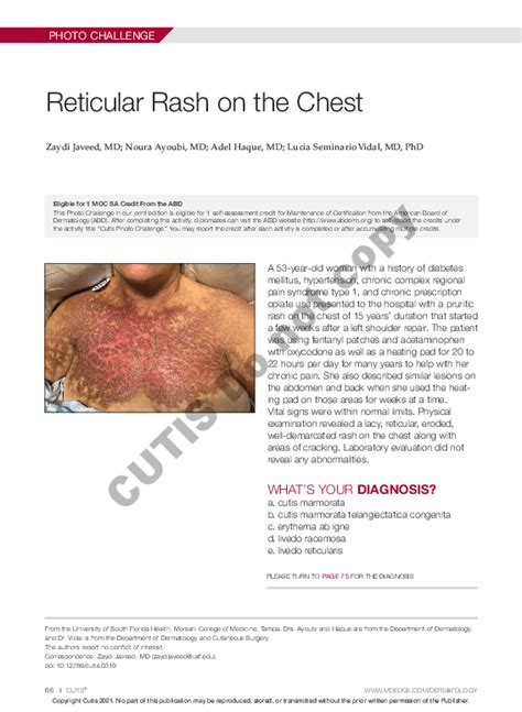 Pdf Reticular Rash On The Chest Adel Haque