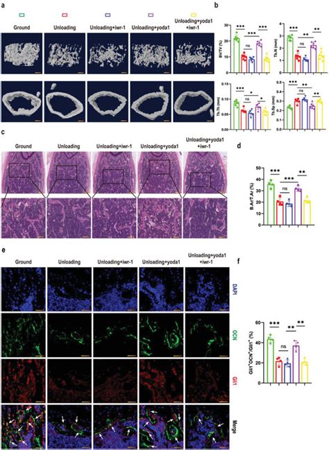 Activation Of Piezo1 Alleviated Bone Loss Under Simulated Microgravity