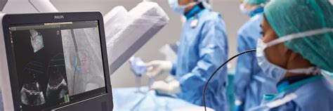 Left Atrial Appendage Occlusion