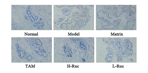 The Vascular Endothelial Cell Surface Marker Cd34 In Breast