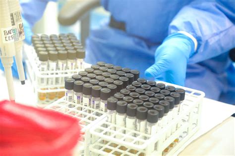 Coronavirus Mujer De 55 Años Años Se Convierte En El Segundo Caso