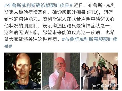 好莱坞影星布鲁斯·威利斯确诊额颞叶痴呆！患病率被低估的无法治愈的疾病 知乎