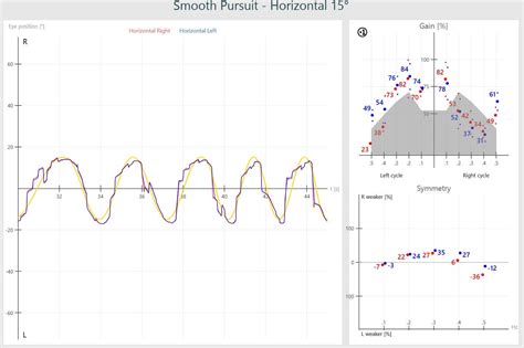 Visualeyes™ Smooth Pursuit Eye Movement Testing Interacoustics