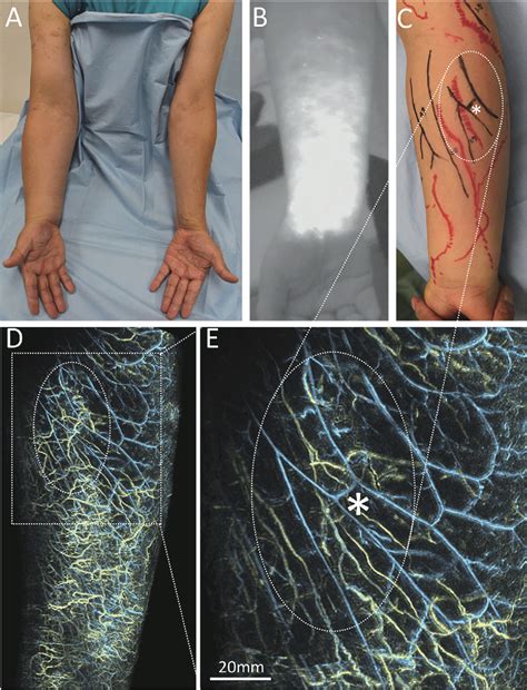 Figure 4 From Review Visualization Of Lymphatic Vessels Using
