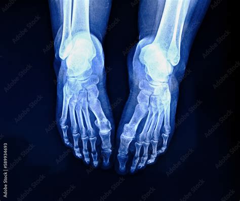 Xray Of Feet On Dashboard At Jason Davies Blog