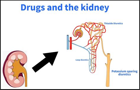 Thiazide Induced Hyponatremia Females Versus Males A Case Report