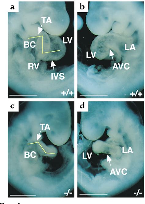 Figure 1 From The Polycomb Group Gene Rae28 Sustains Nkx2 5 Csx