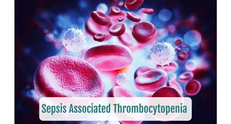Sepsis Now Part Of Cms Value Based Purchasing Program Sepsis Program