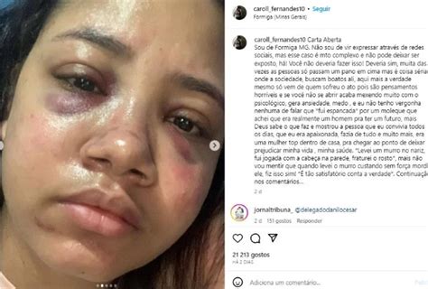 Mulher é agredida pelo ex marido e expõe fotos e relato na internet