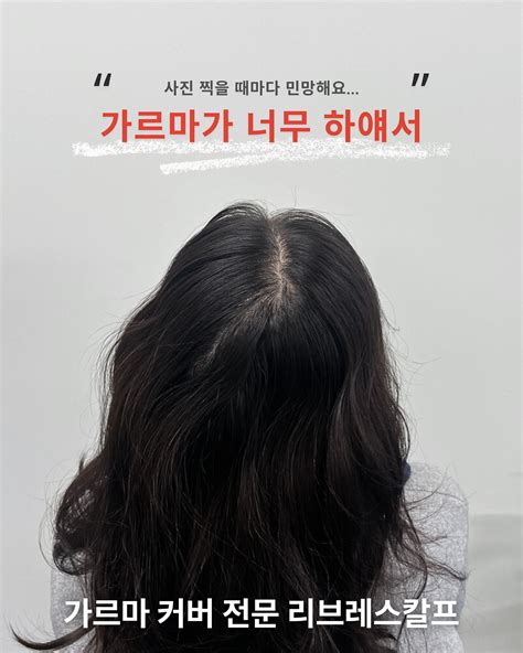 💡고급스러운 숱채움의 정석 부천두피문신 신중동두피문신 상동두피문신 부천탈모관리⎪리브레스칼프🇰🇷 • 옆으로 넘겨 차이를 확인하세요 거울 볼 때 드라이 할 때 사진
