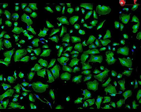 Human Pulmonary Alveolar Epithelial Cells Hpaepic
