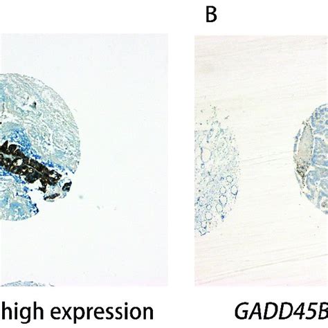 Nodes Removed In Inguinal Versus Ilioinguinal Completion Lymph Node