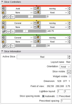 Modules Slices Documentation 3 4 Slicer Wiki