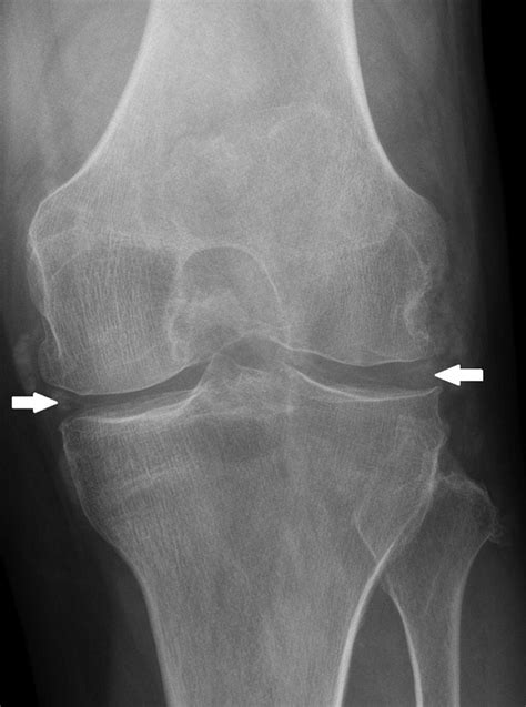 Musculoskeletal Radiology Musculoskeletal Key