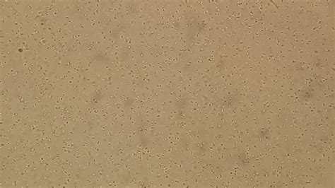 Proteus Penneri Introduction Morphology Pathogenicity Lab Dia