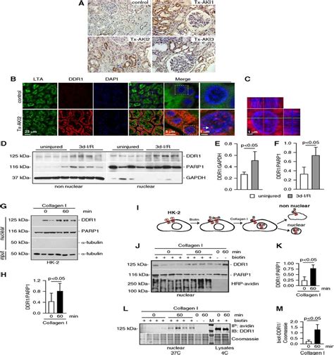 The Extracellular Matrix Receptor Discoidin Domain Receptor
