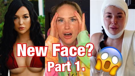 Plastic Surgery Vlog Part 1 Youtube