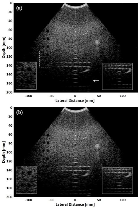 ultrasound b mode imaging results of chirp coded excitation with a