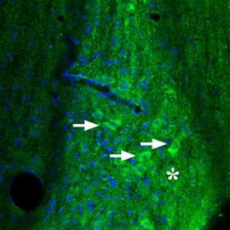 Adenosine A2a Receptor Polyclonal Antibody Aar 002 200ul
