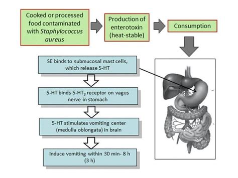Infectious Enteritis And Food Poisoningpptx
