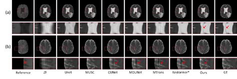 Figure 1 From Decomposition Based Variational Network For Multi Contrast Mri Super Resolution