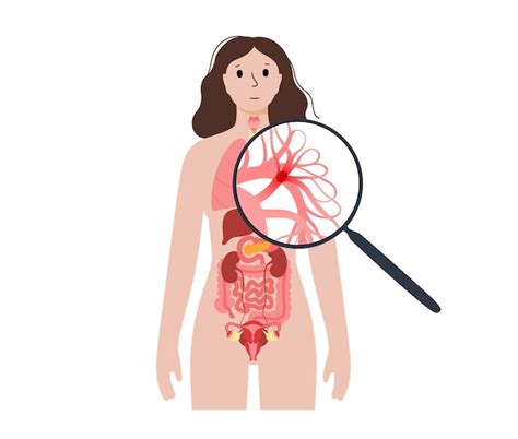 Doença de embolia pulmonar Vetor Premium