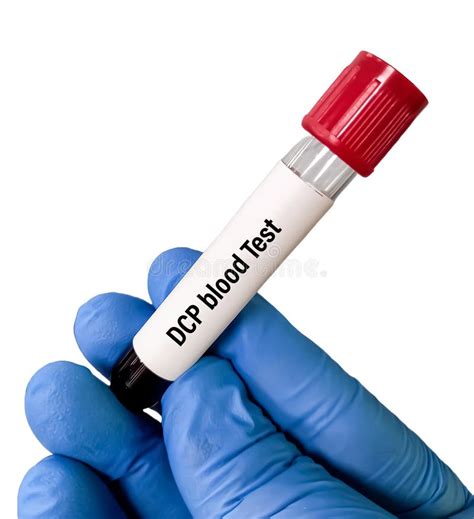 Amostra De Sangue Para O Teste Dcp De Protrombina De Desgammacarboxe