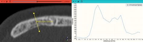 Accuracy Of Segmentation Smoothing Support 3d Slicer Community