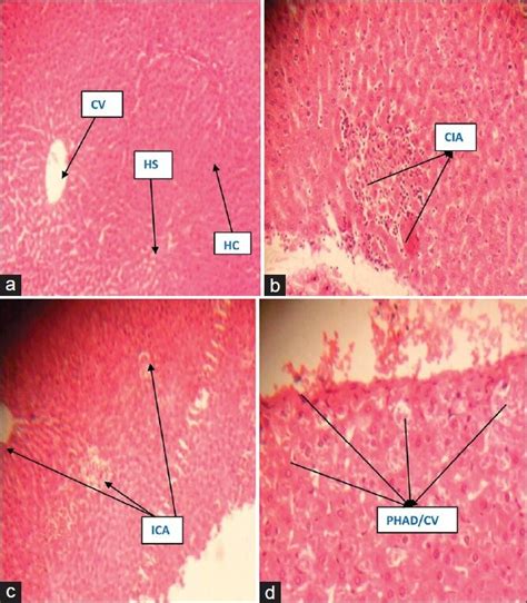 Photomicrograph Of Liver Sections Of Albino Rats Stained With
