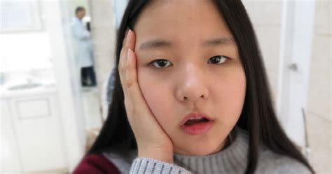 관자놀이 두통과 어지럼증 턱관절아픔부터 치료해야