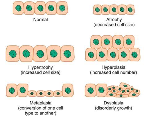 Cellular Adaptation Table Diagram Quizlet