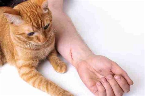 Pcr Test Helps To Detect Cat Scratch Disease