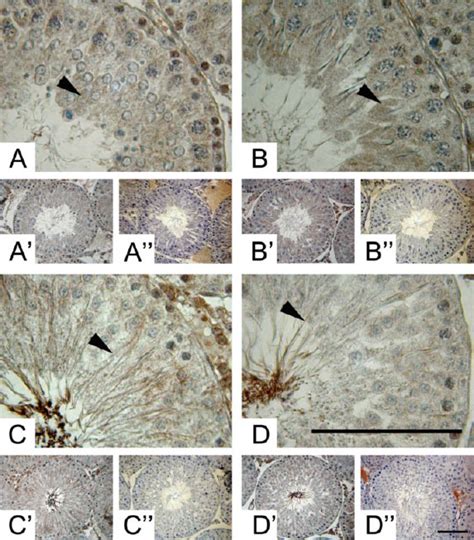 Differential Expression And Localization Of Adam10 And Adam17 During