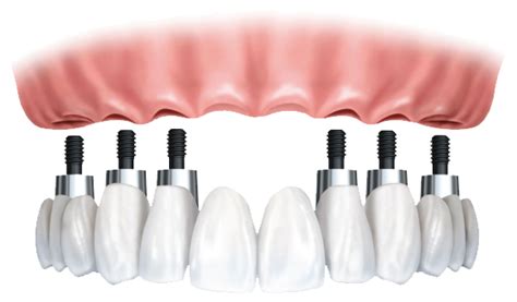 Crosspoint Dentistry